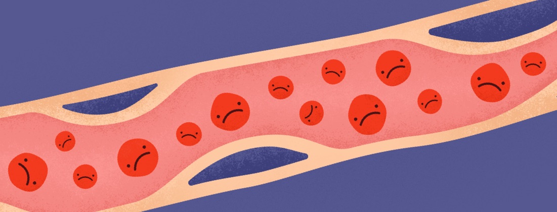 What is Myelofibrosis? | Blood-Cancer.com