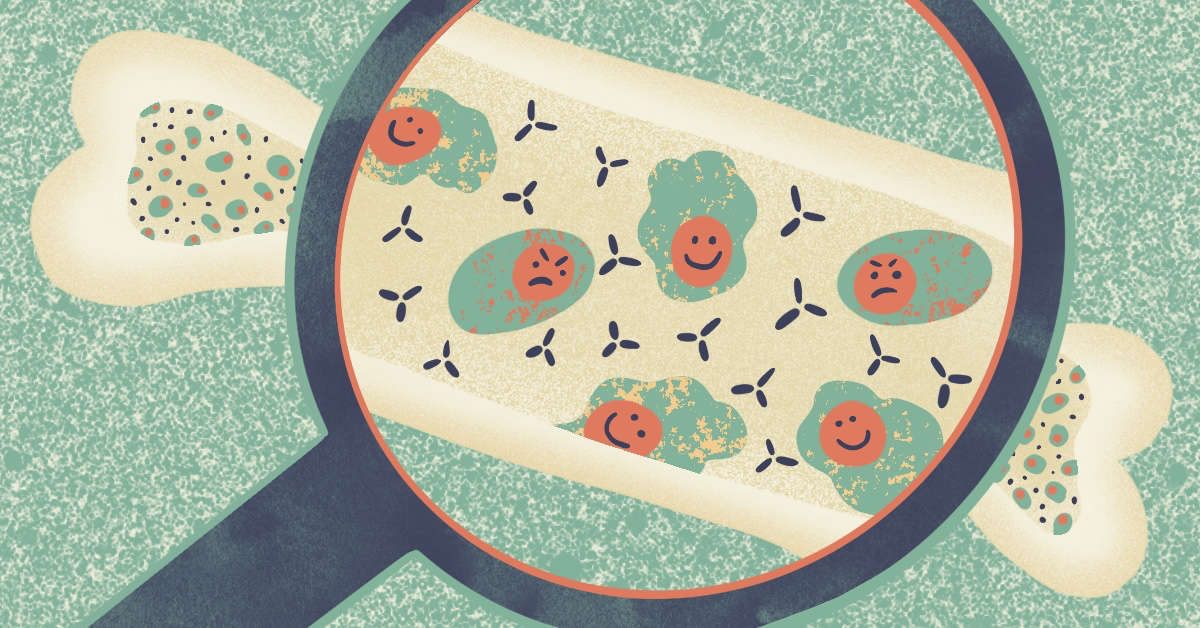 Bone Marrow Biopsy Prep and Recovery | Blood-Cancer.com